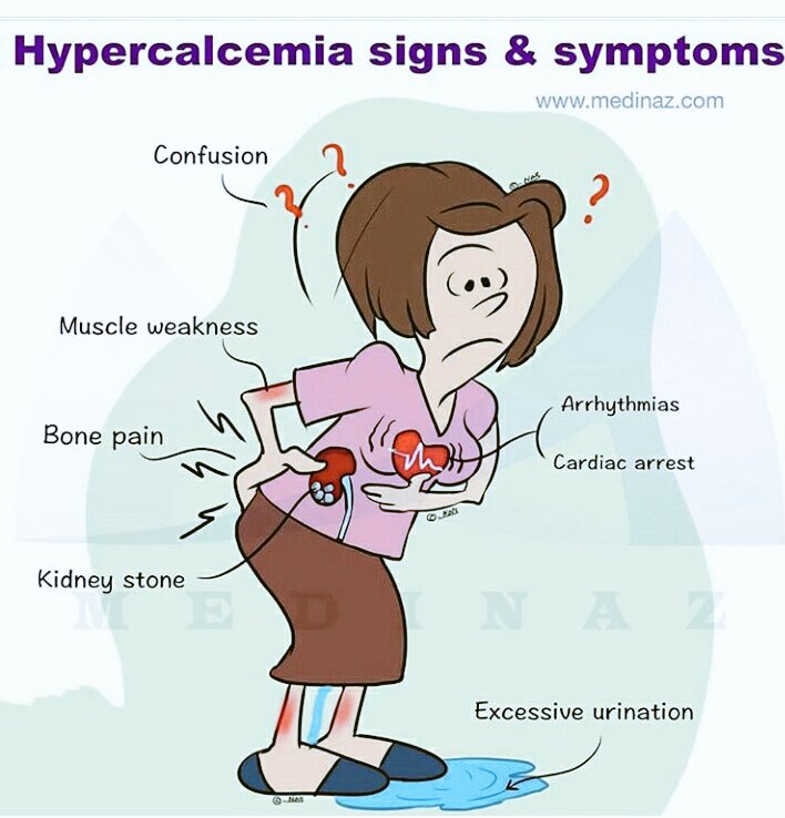 Hypercalcemia