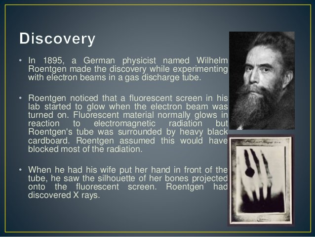 William Roentgen Invented X Rays