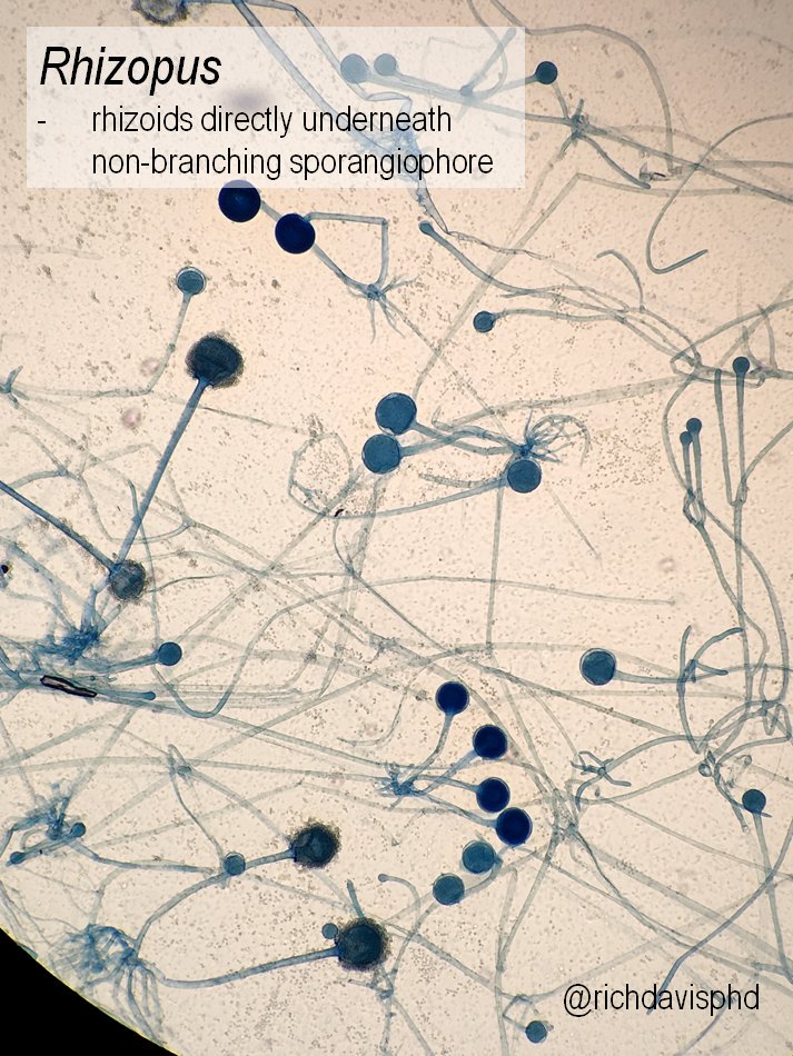 Rhizopus Under Microscope