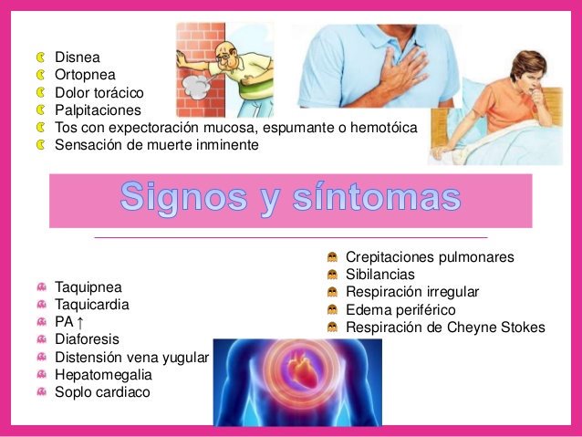 Signos Y Sintomas De Edema Pulmonar