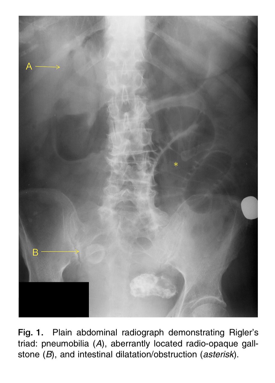 Plain Abdominal Radiograph