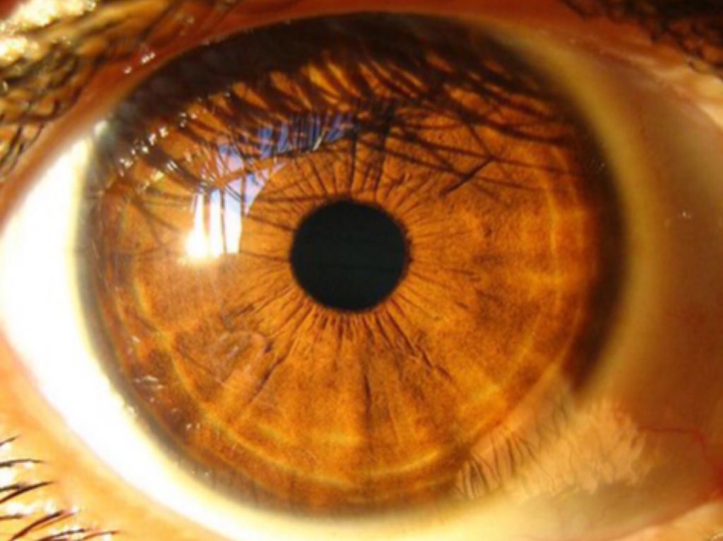 Brown Eyes In Sunlight