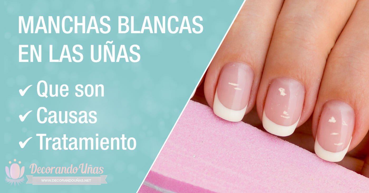 Causas De Leuconiquia