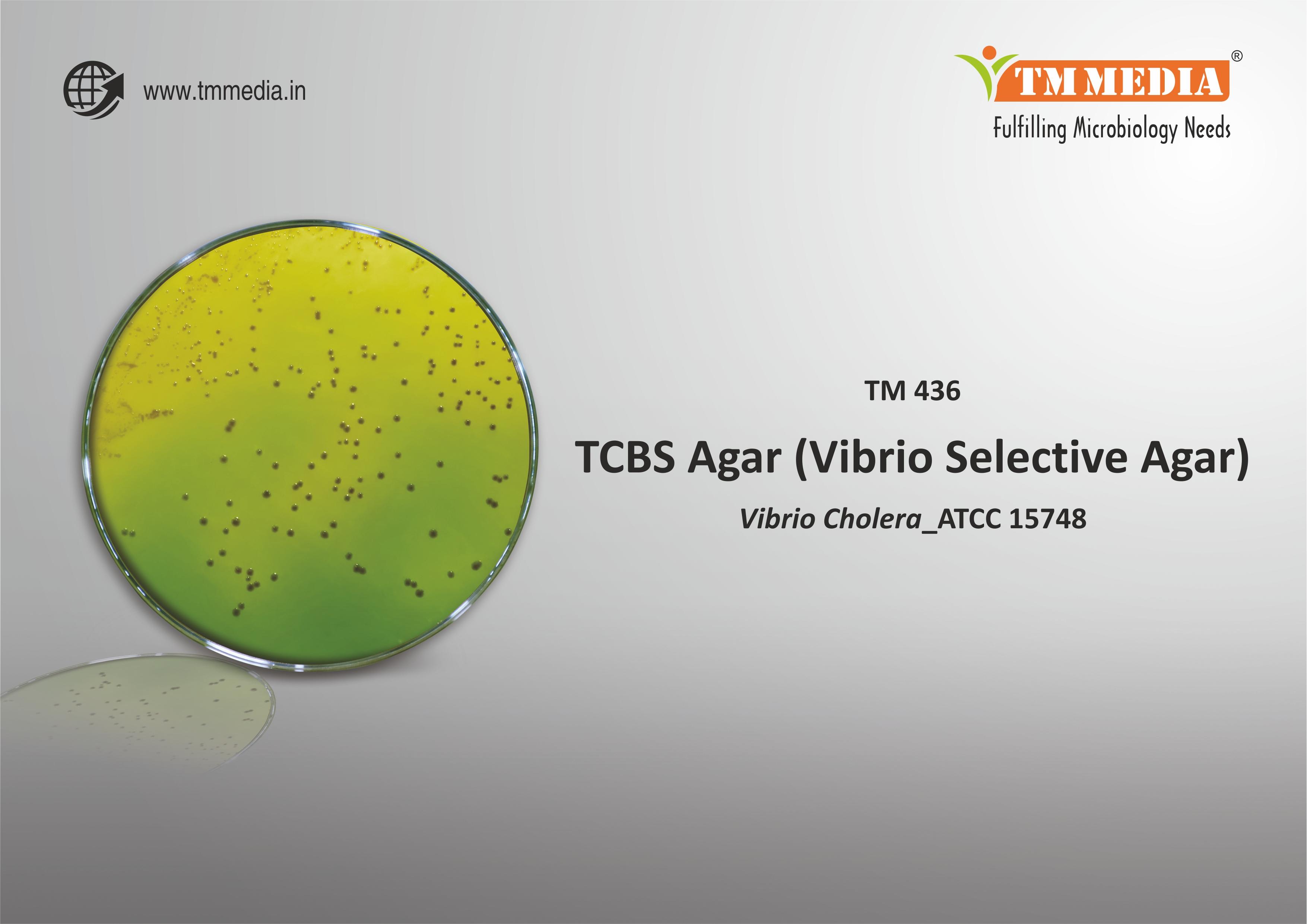 Vibrio Cholerae Tcbs