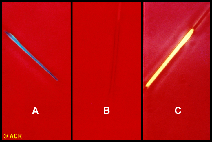 Polarized Light Microscopy Crystals