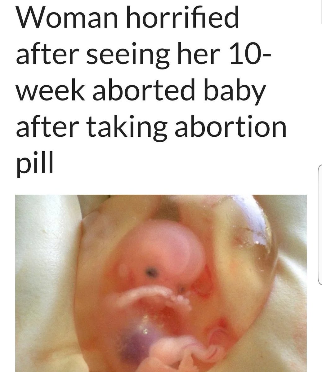 Abortion Pictures 10 Weeks