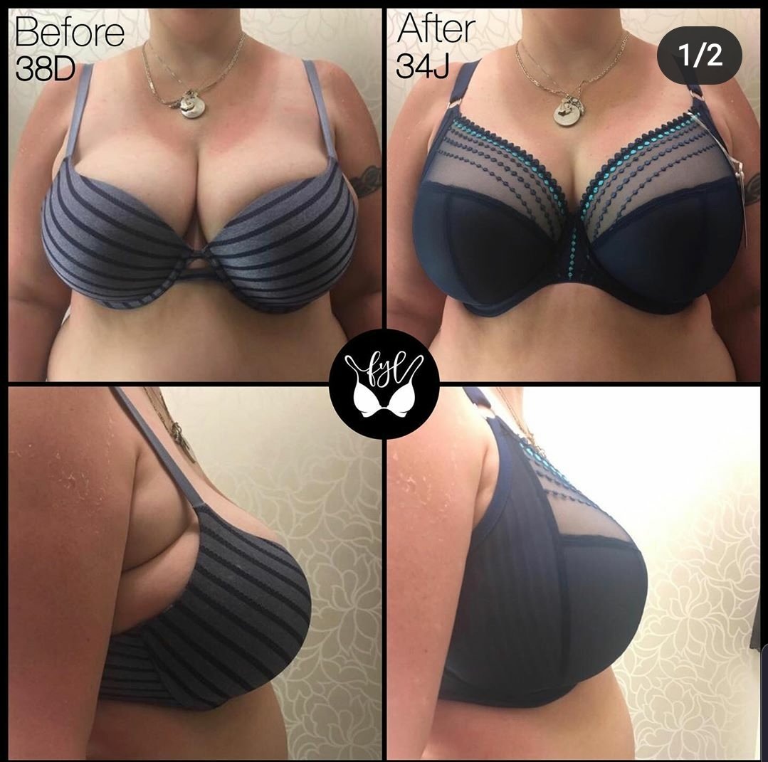 38d Implants
