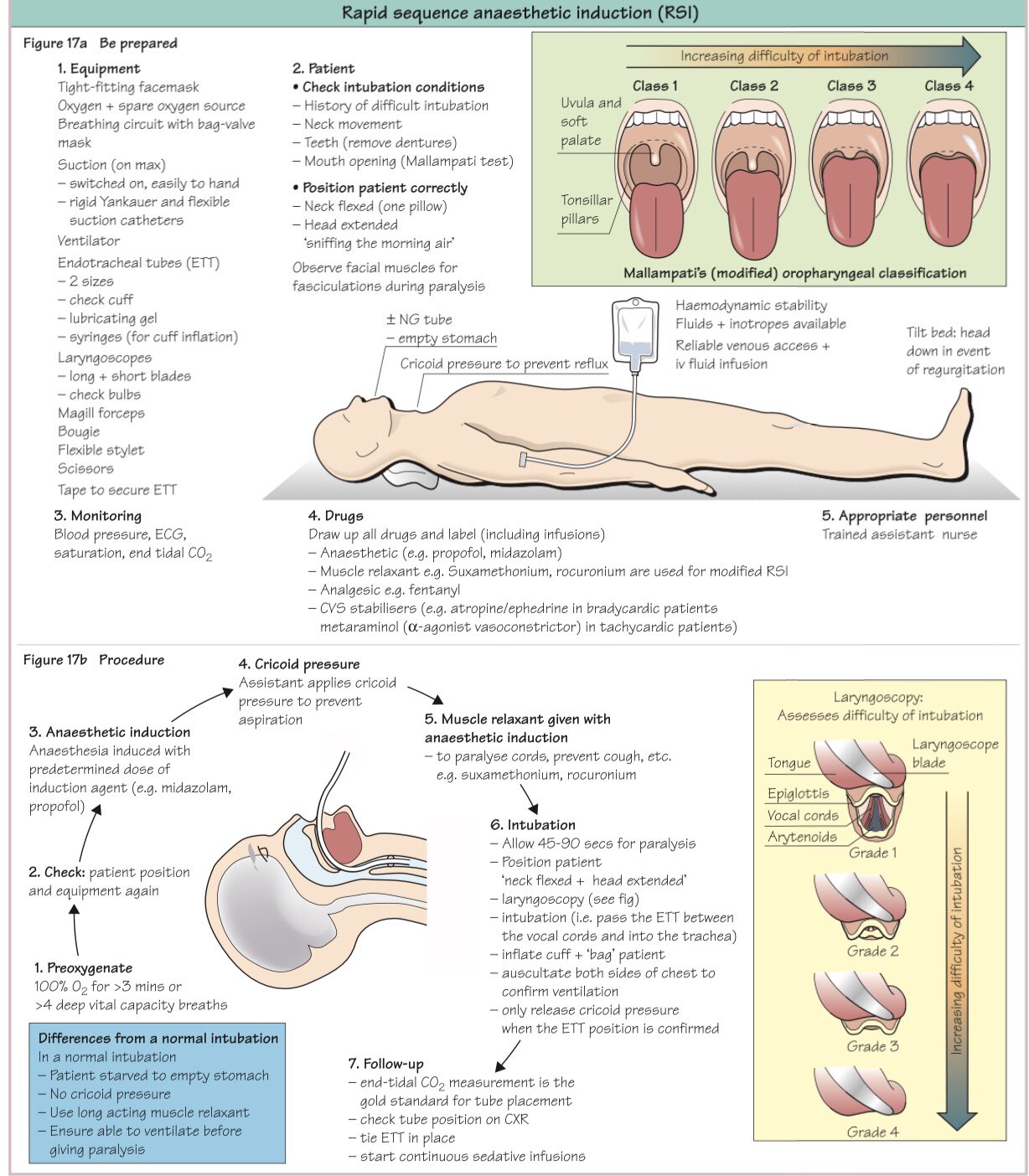 Rapid Induction Anesthesia