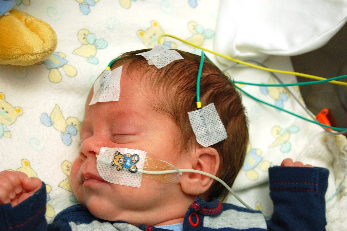 John F. Cryan on Twitter: "RT @infantcentre: Neonatal seizures remain a major challenge for ...