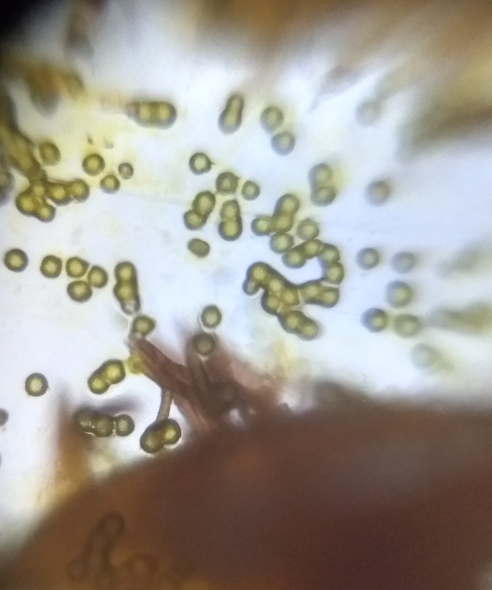 Pollen Grain In Urine