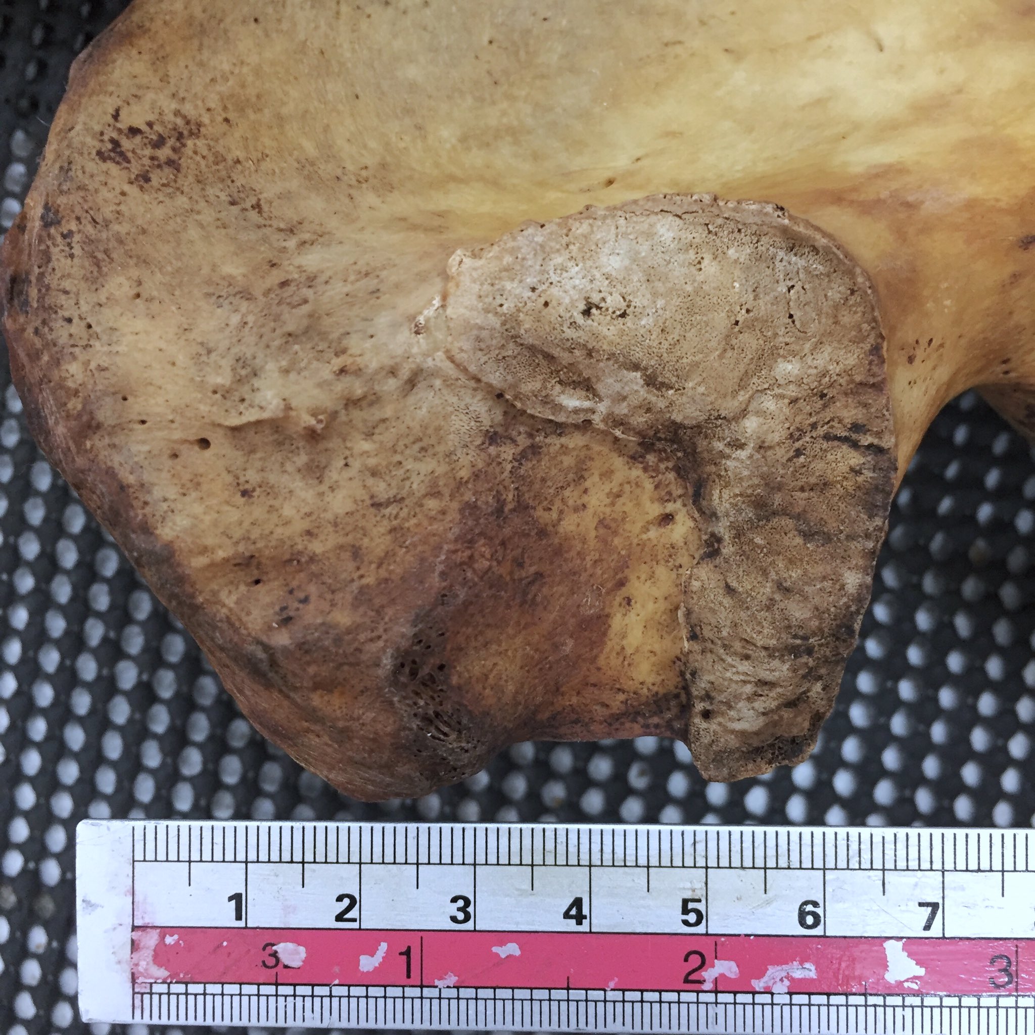 Auricular Surface Age