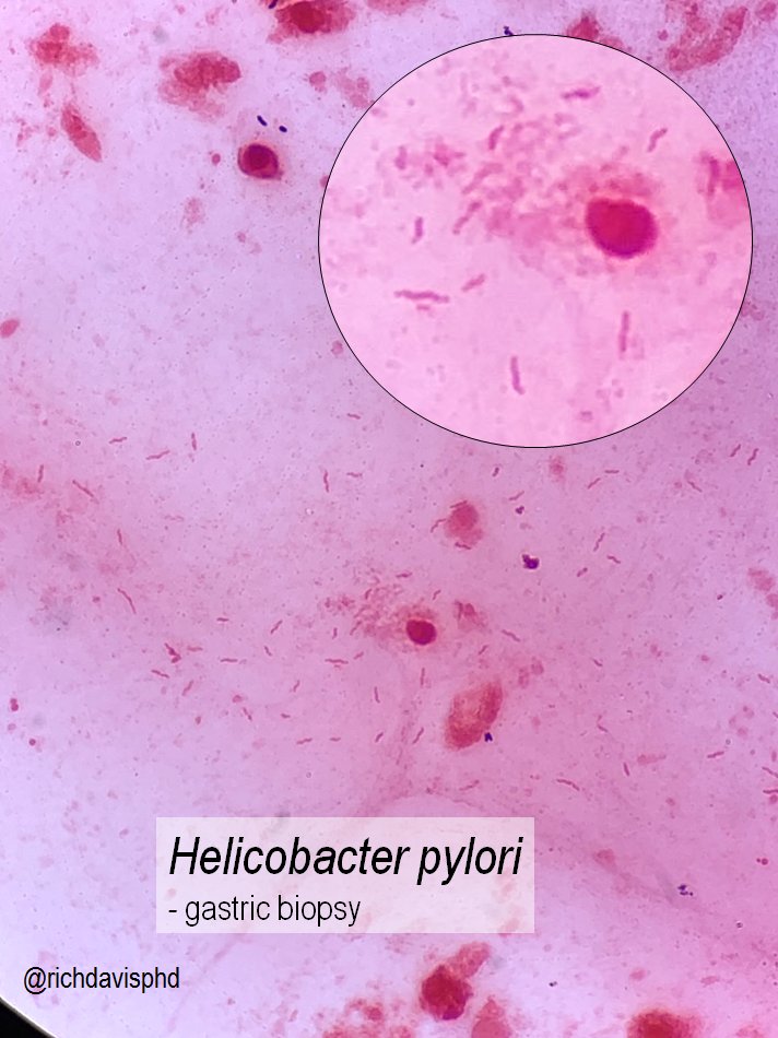 Helicobacter Pylori Culture