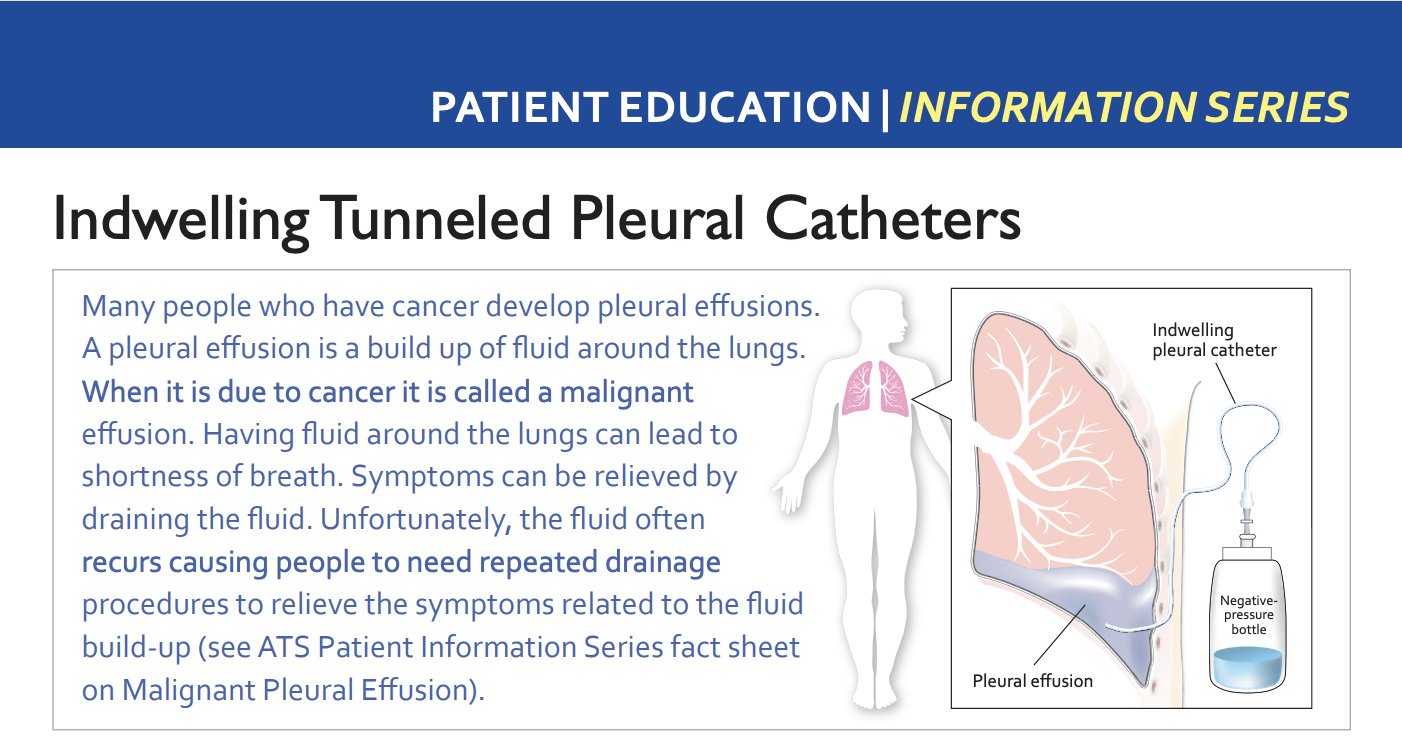 Indwelling Pleural Catheter