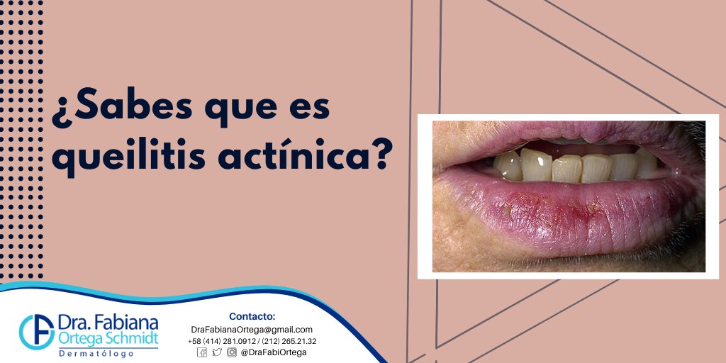 bendición pronto enlace queilitis actínica labial Malawi equipo Complacer