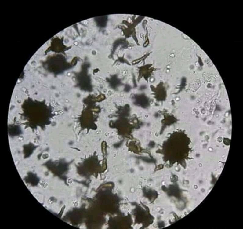 Ammonium Biurate Crystals Dog