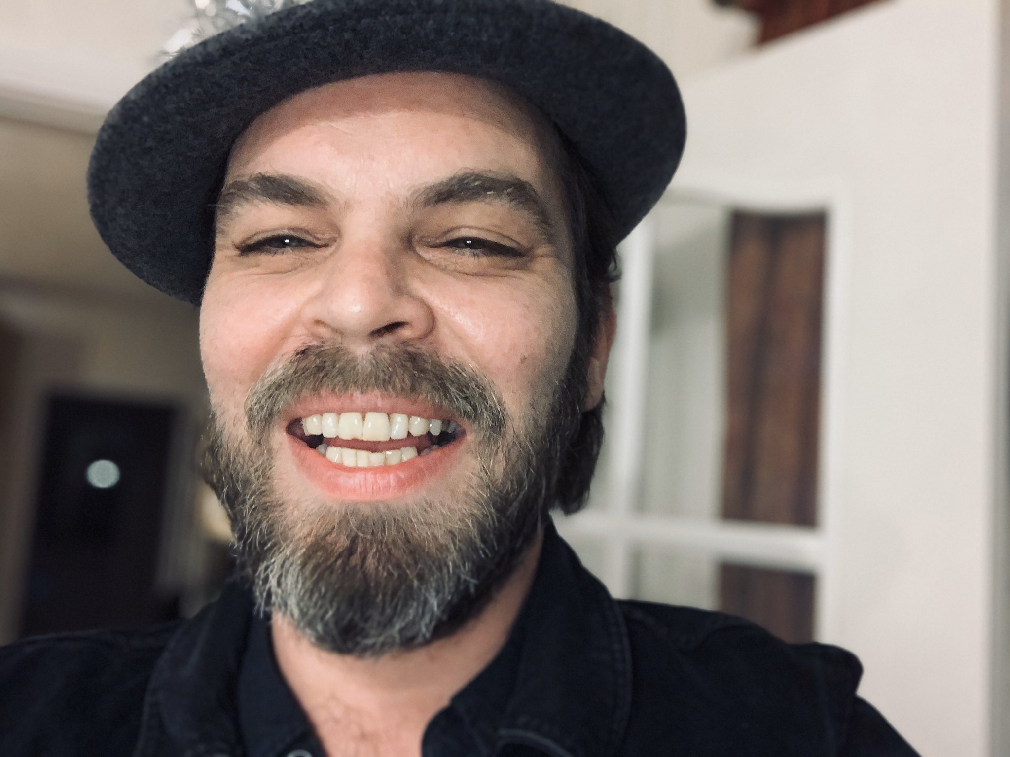GAZ COOMBES :"VOLVER A SUPERGRASS NO FUE "UN PASO ATRÁS" | PyD