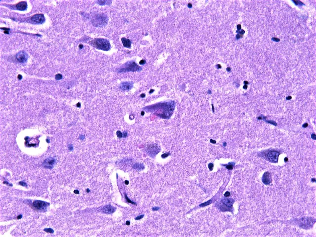 Pyramidal Cell Histology