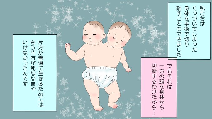 【漫画】もし結合性双生児になったら?双頭人間の衝撃的な生態② 動画版.. | ダヴィンチアカデミー さんのマンガ | ツイコミ(仮)
