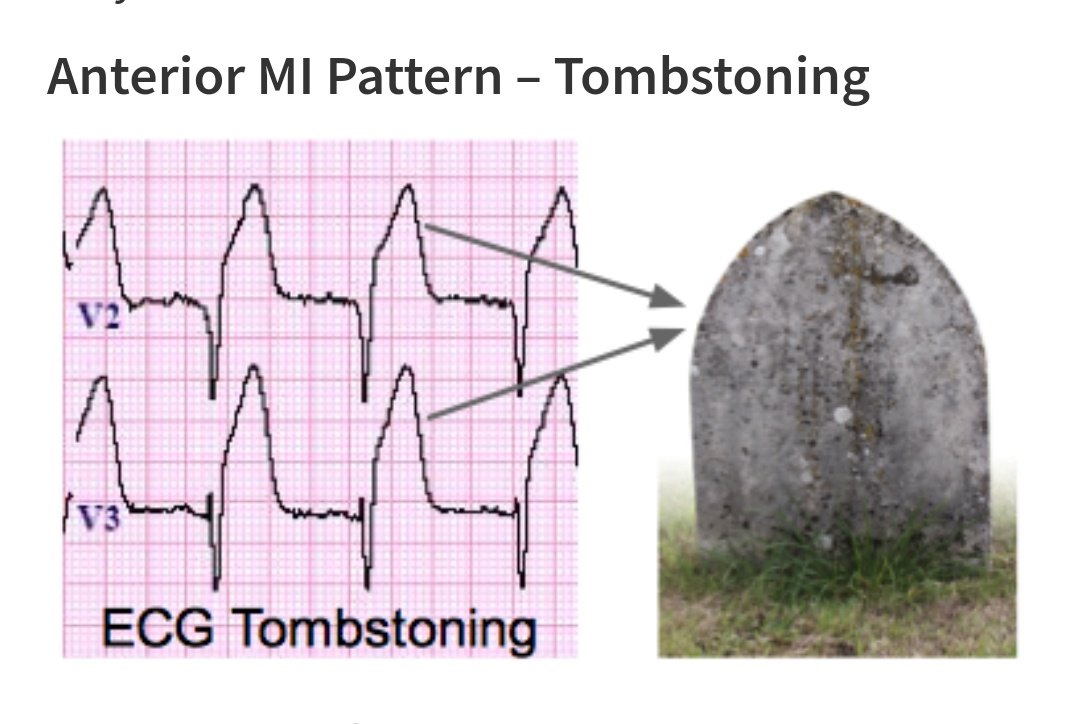 St Elevation Tombstone