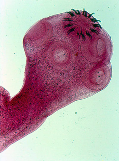 T. solium mide entre 2 y 7 metros de longitud y tiene una "cabeza ...