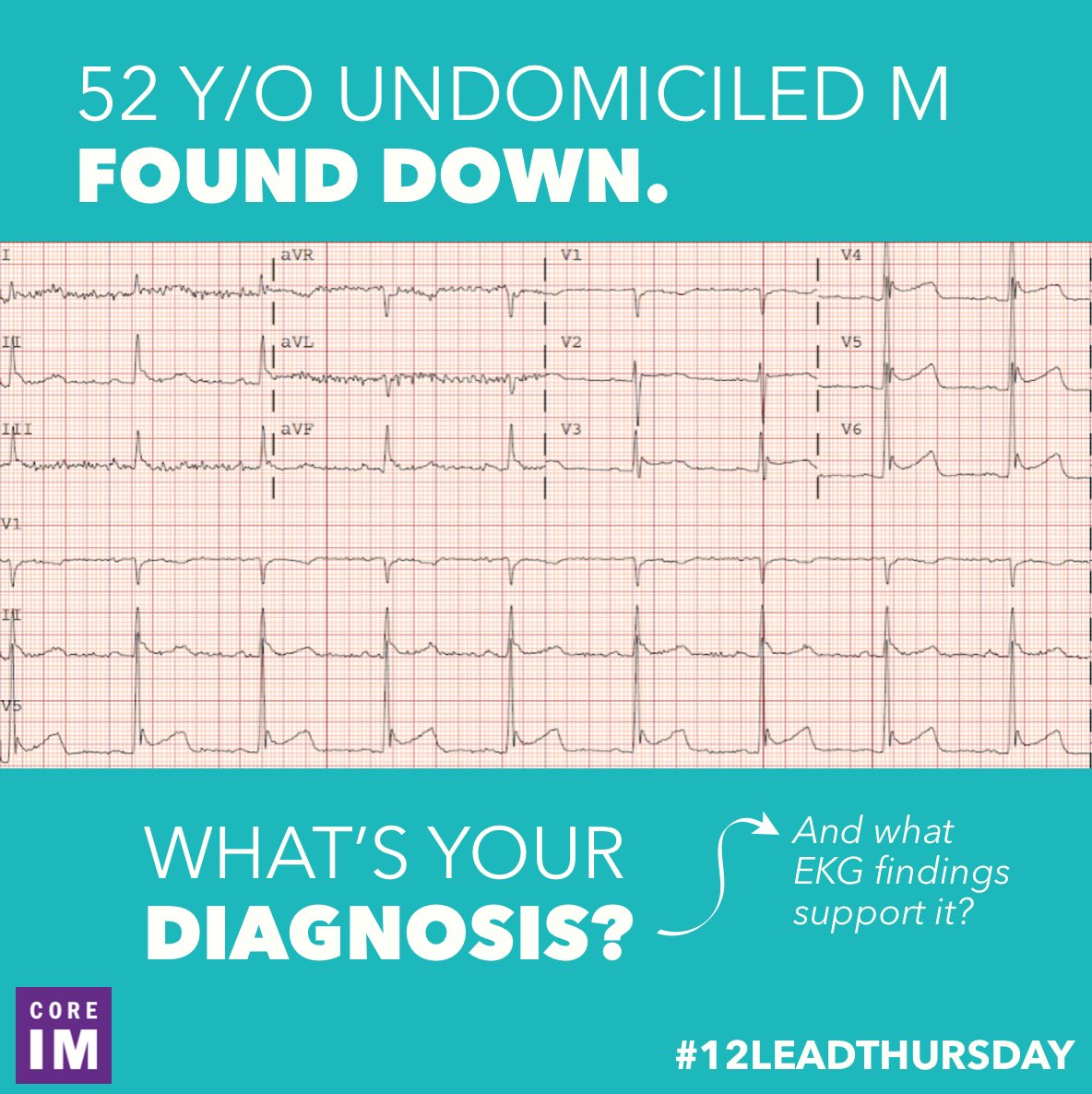 1/ After this week’s #12LeadThursday, don’t ever let anyone tell you ...