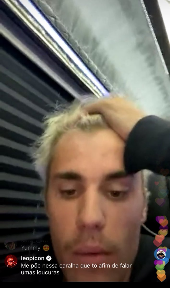 Justin Bieber Bald