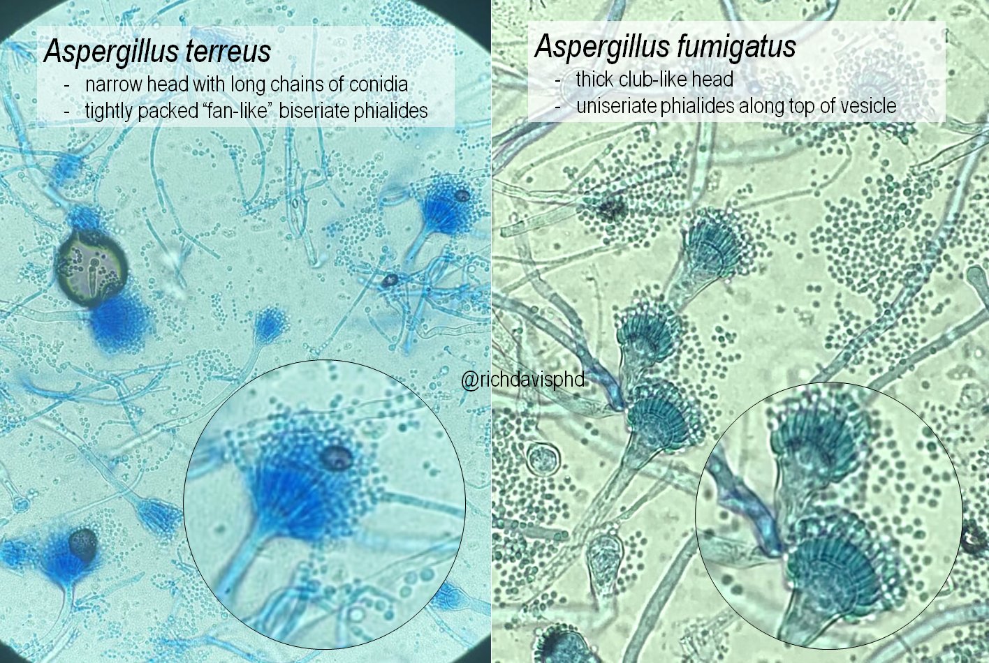 Aspergillus Terreus