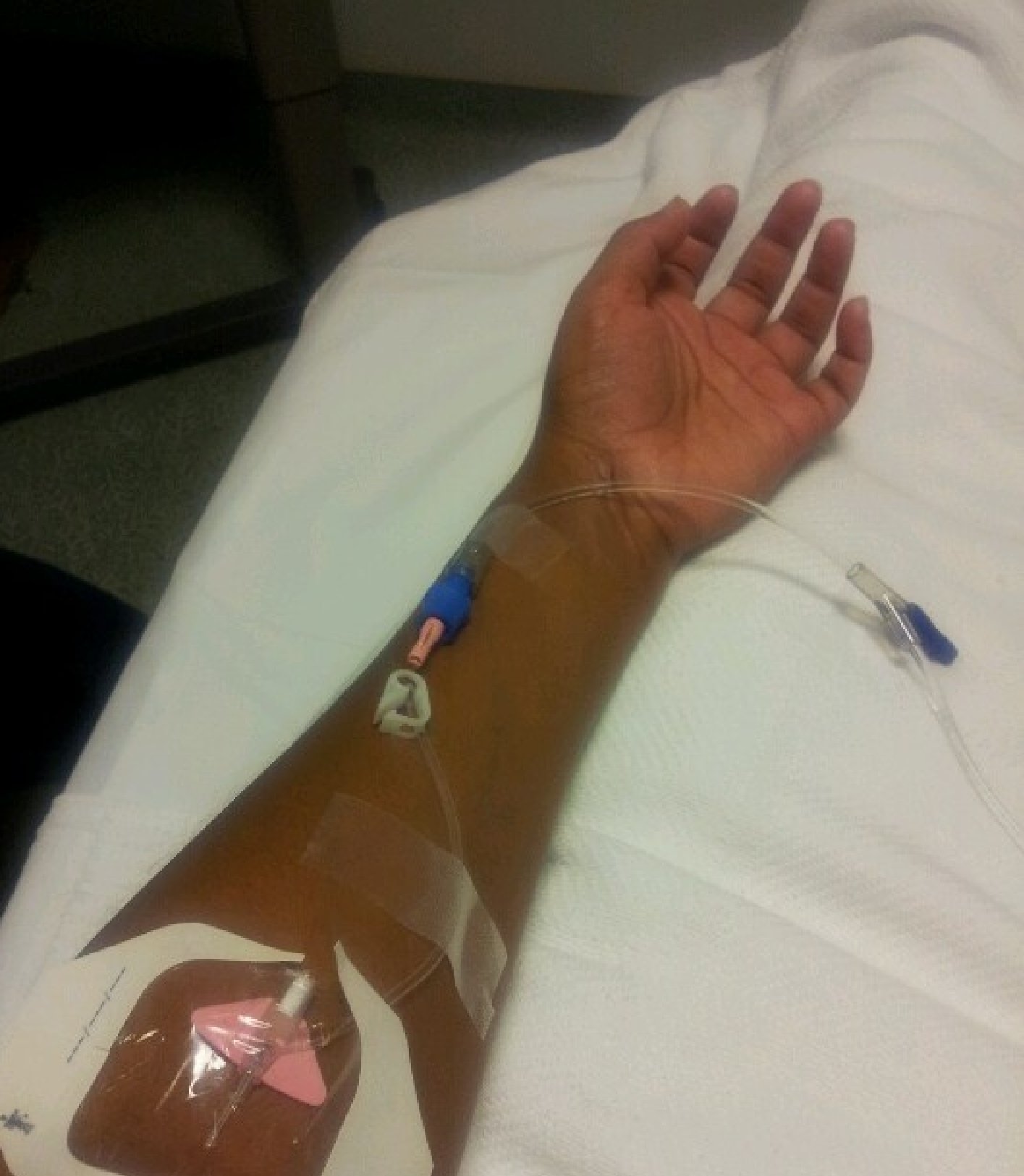 Hospital Needles In Arm