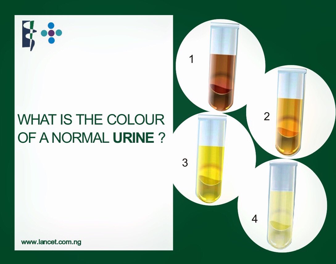 Normal Urine