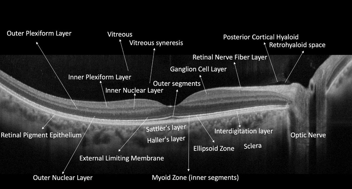 Anatomía De Las Capas De La Retina
