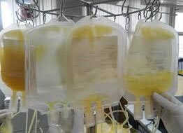 CRYOPRECIPITATE 🩸 ما هو الكرايو بريسيبتيت ؟ ما هو المكون السري المركّز ...