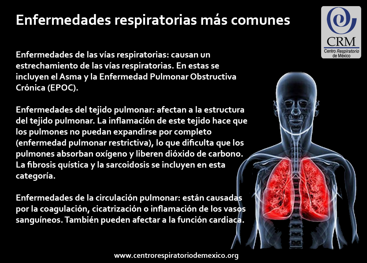 El Sistema Respiratorio Principales Caractersticas