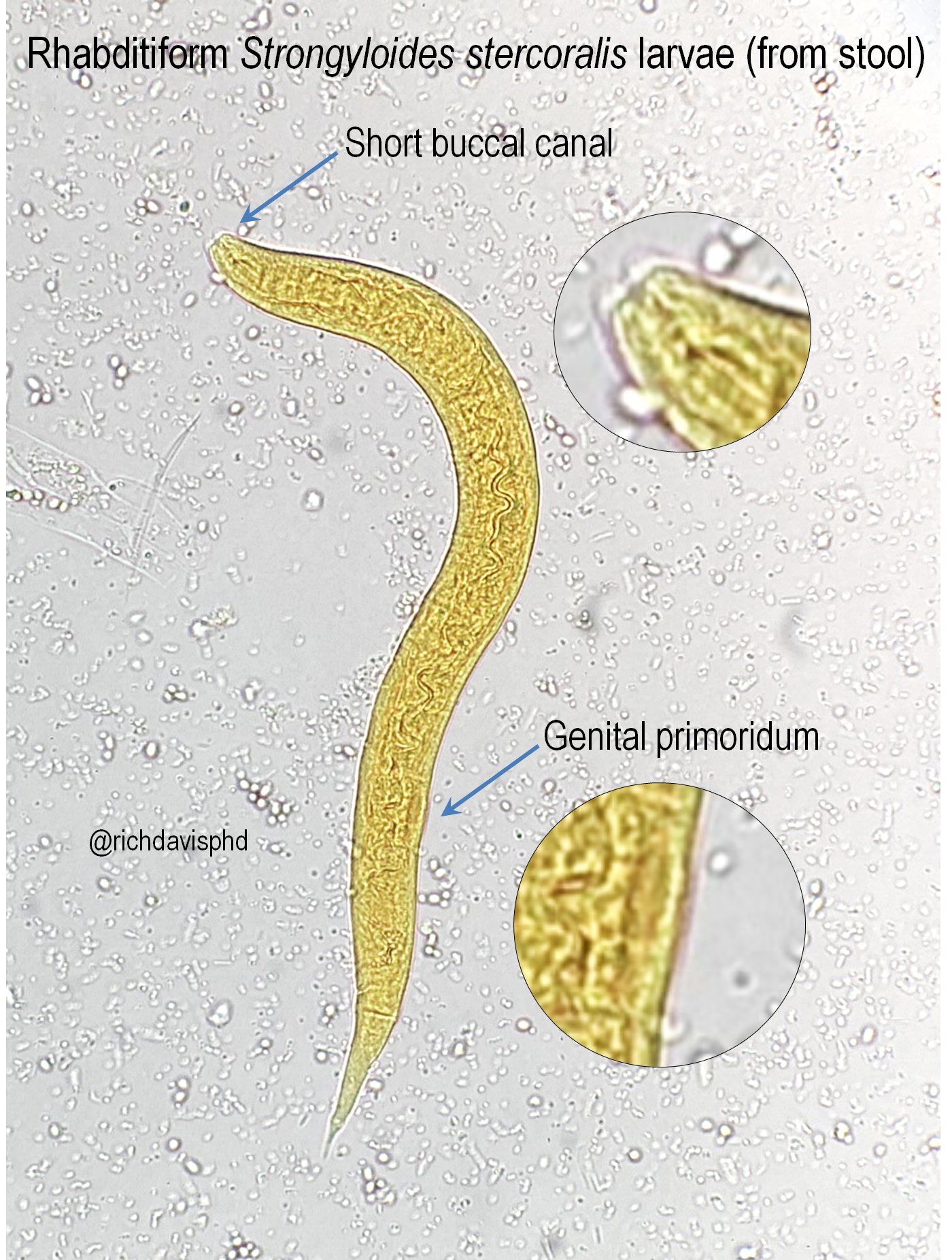 Strongyloides How Do You Get