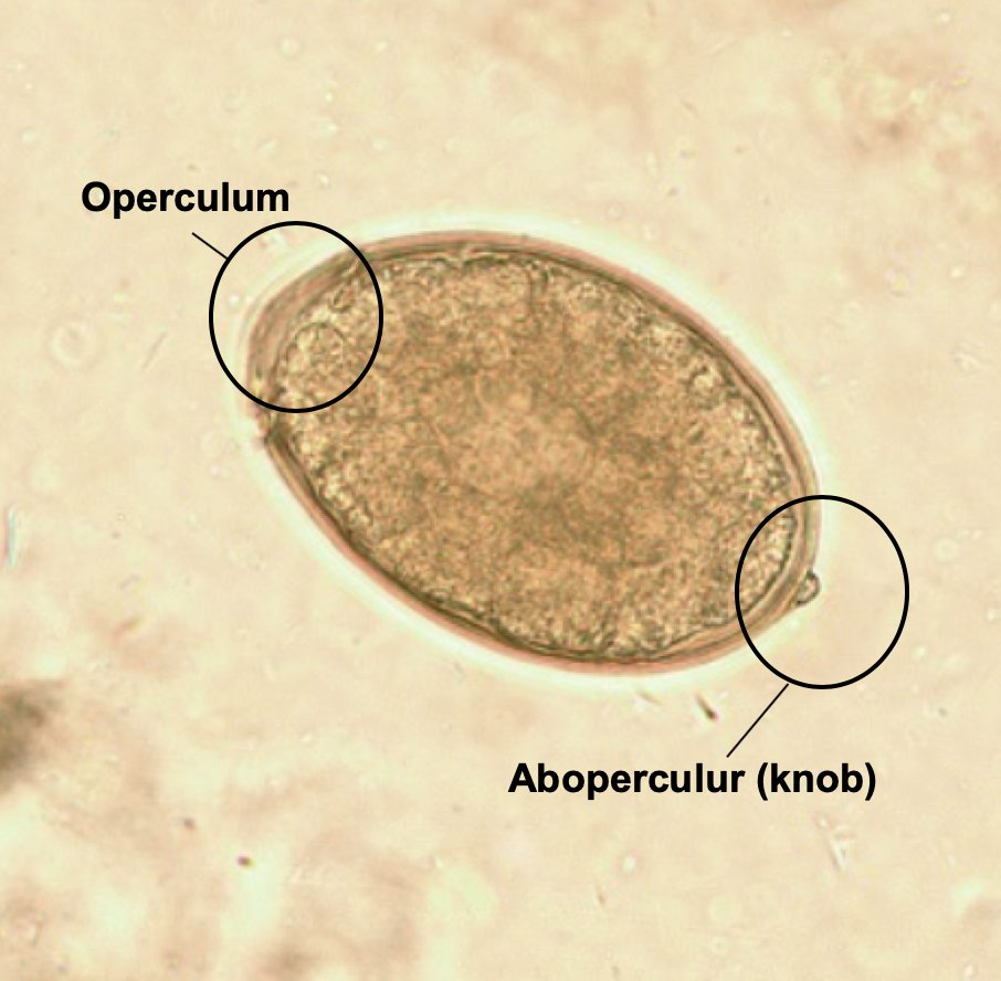 Diphyllobothrium Latum Egg