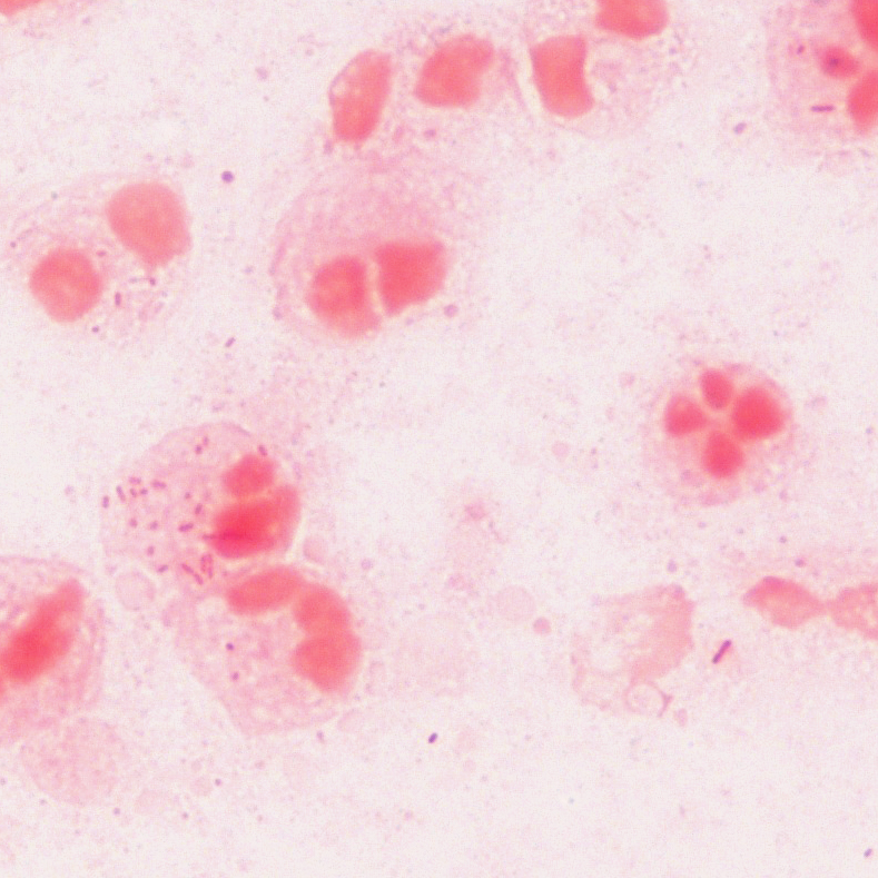 Haemophilus Gram Stain