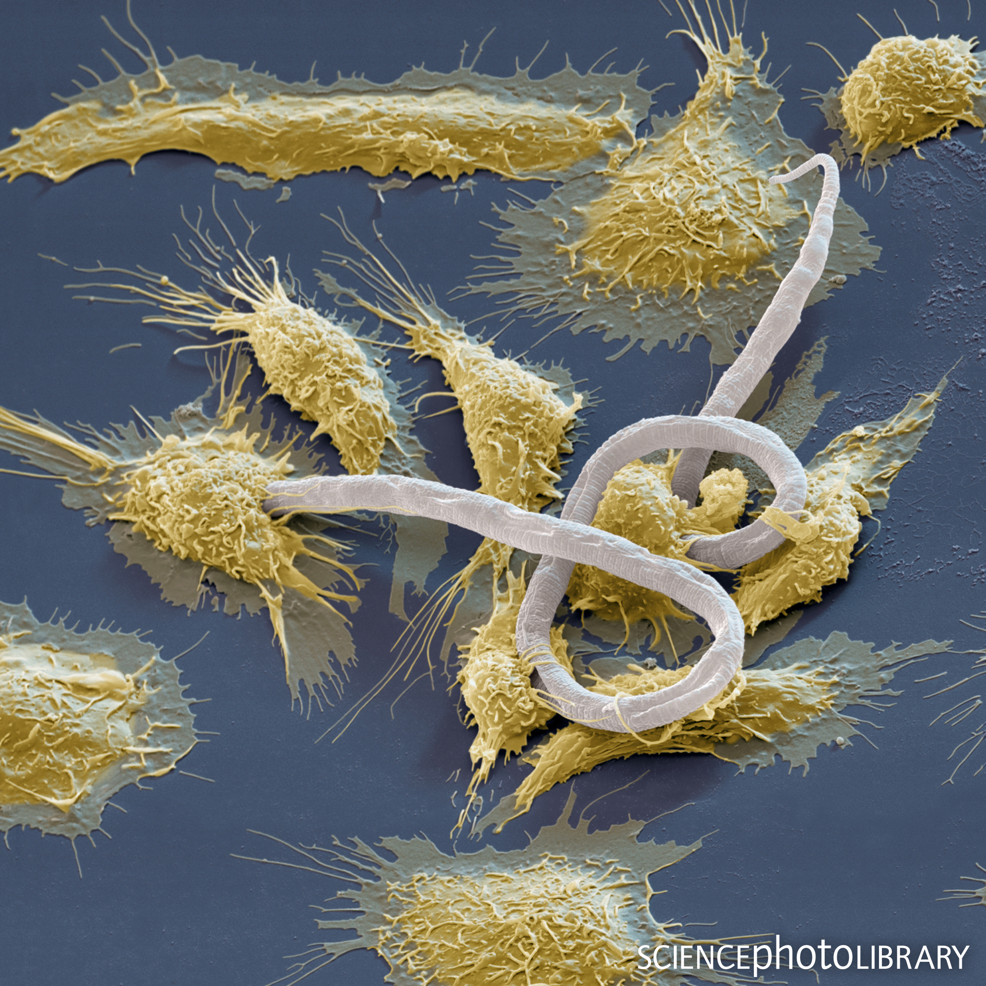 Wuchereria Bancrofti Larvae