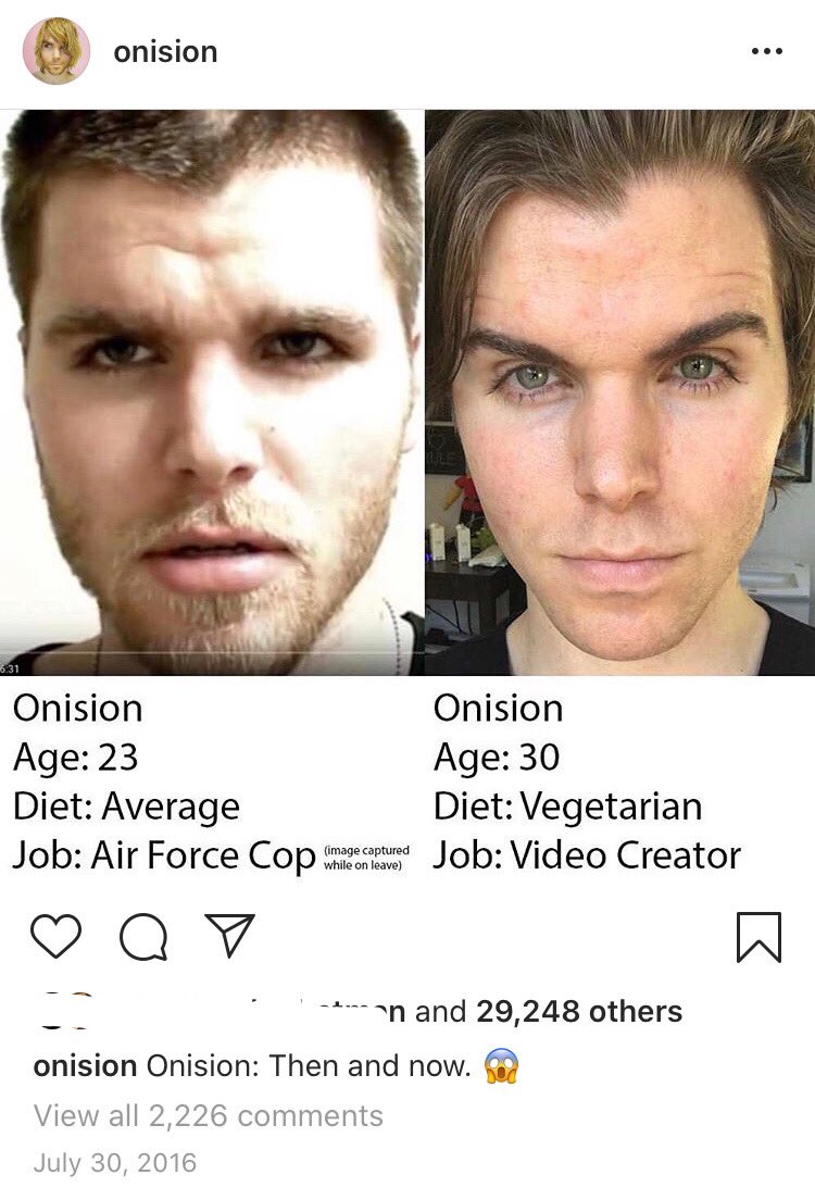 Gregory Onision