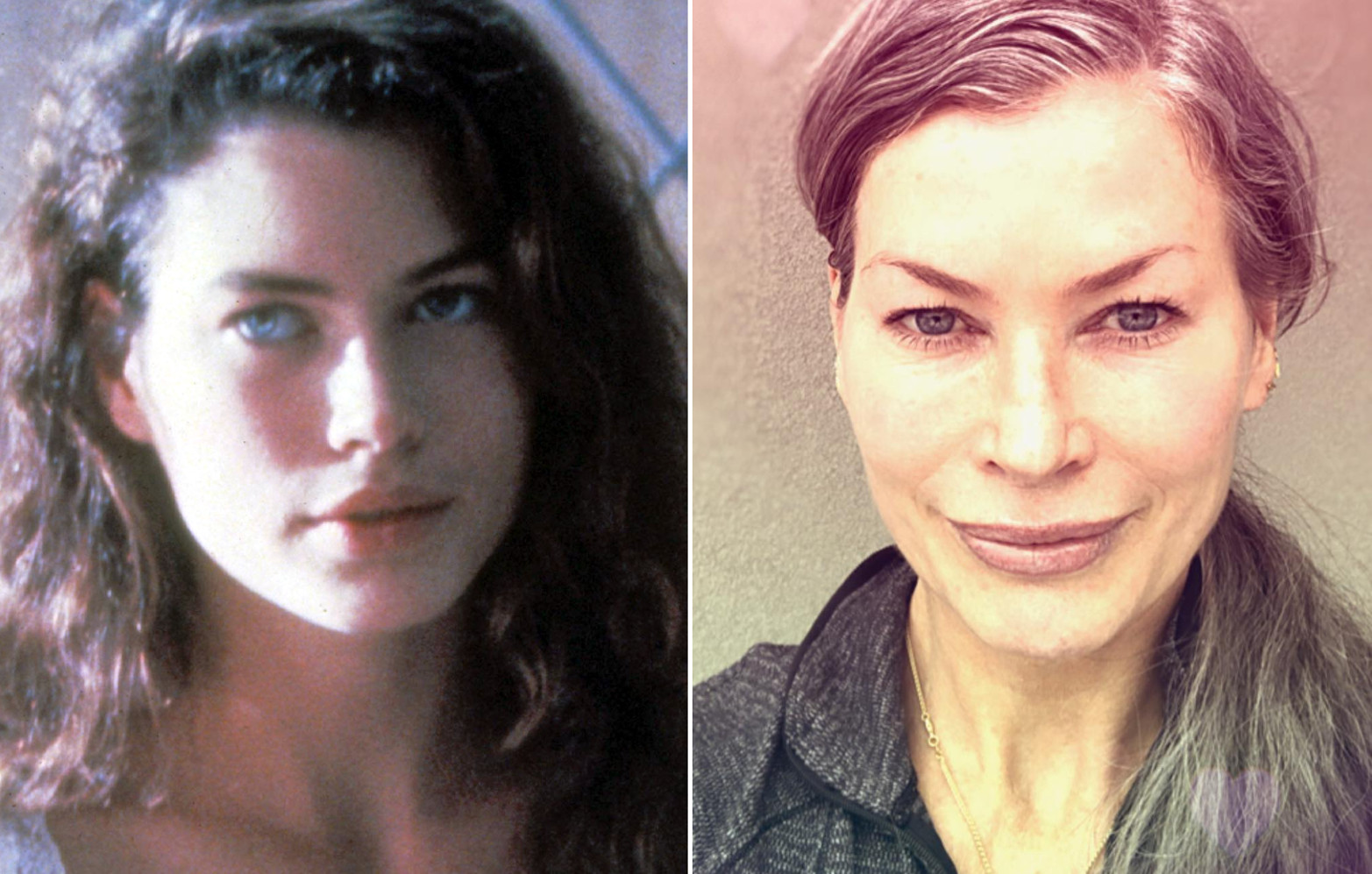 Carre Otis Plastic Surgery