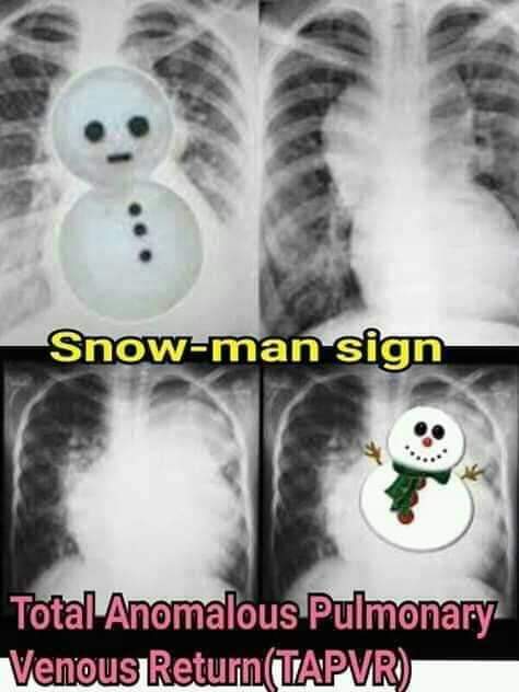 Tapvr Snowman Sign In