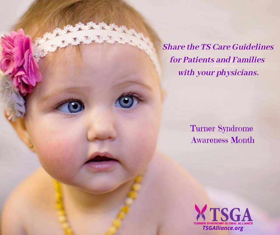 Turner Syndrome Baby