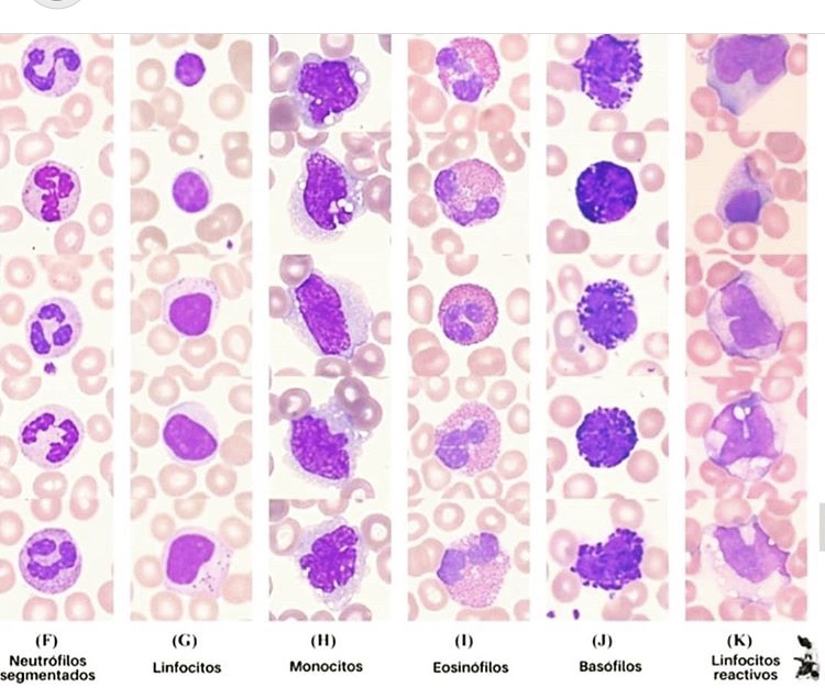 Linfocitos Reactivos