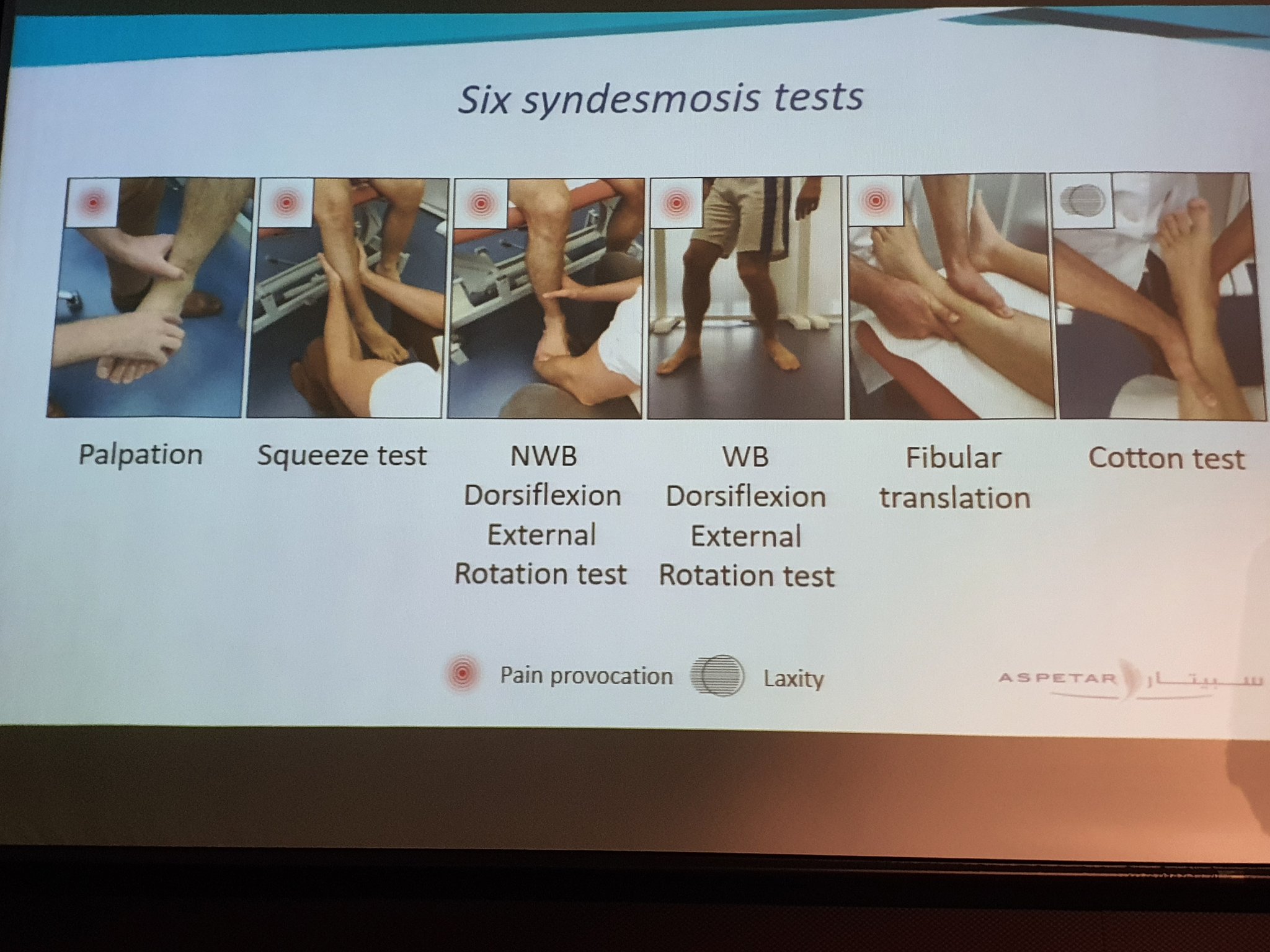 Laxity Exam
