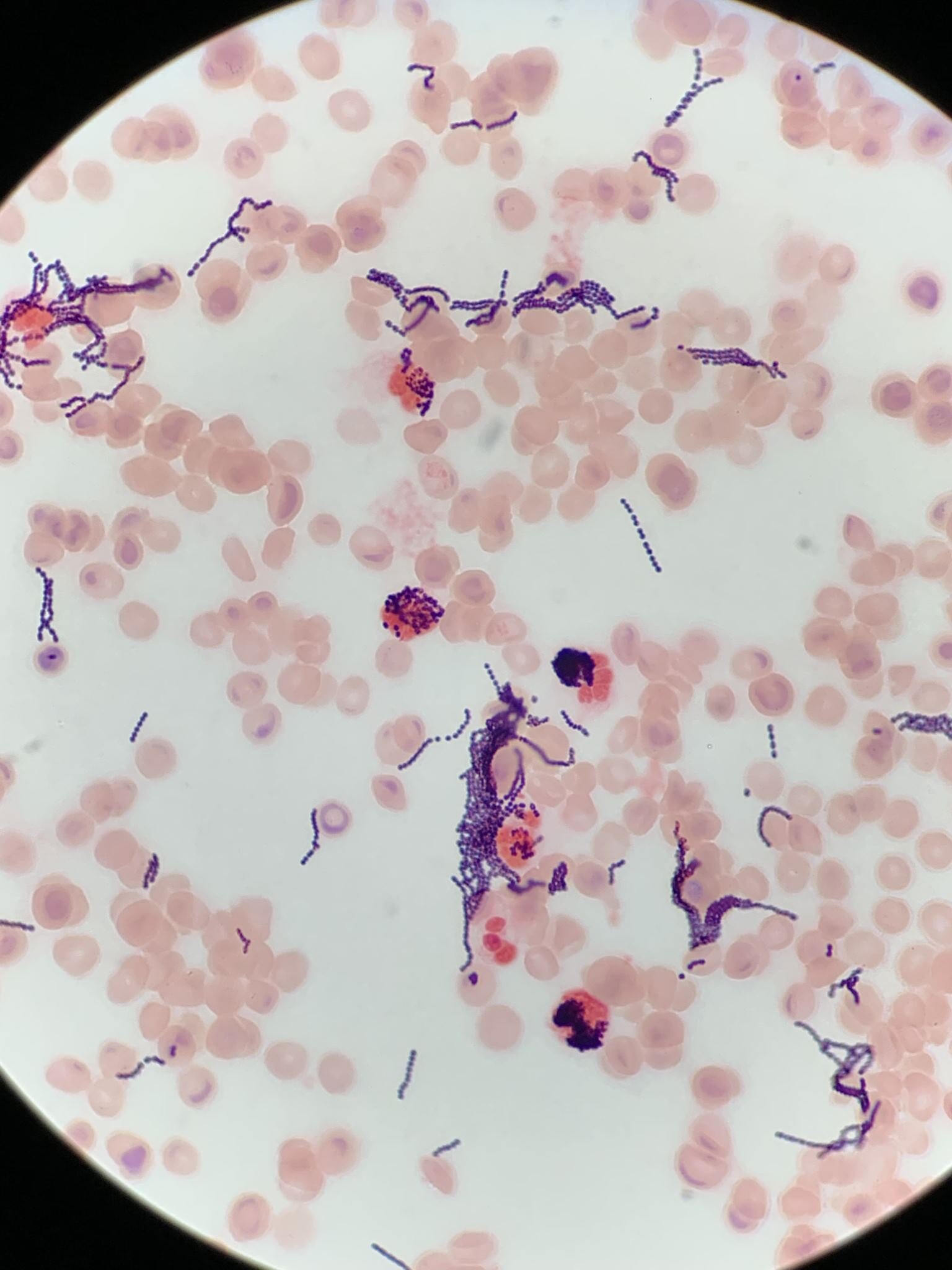 Streptococcus Agalactiae Gram Stain