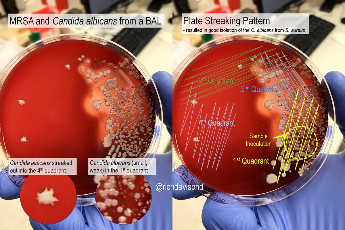 Isolation Streak With Quadrants