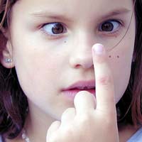 Binocular Convergence