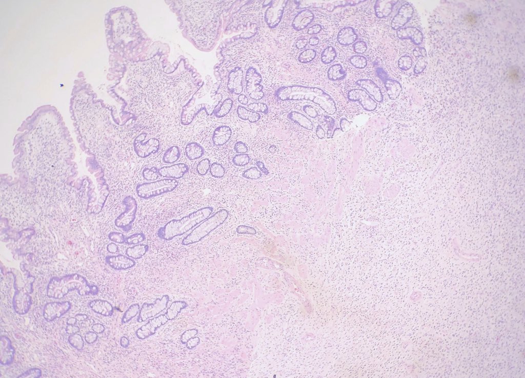 FDA Guidance to Control for Bacterial Contamination in Platelets