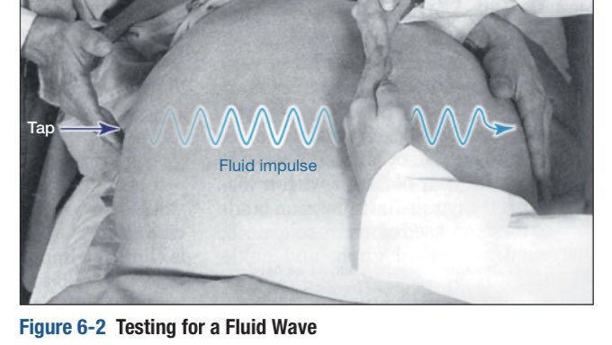 Mejorar Vacunar asignar signo de oleada Flecha Mojado Hacia fuera