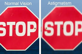Astigmatism Example