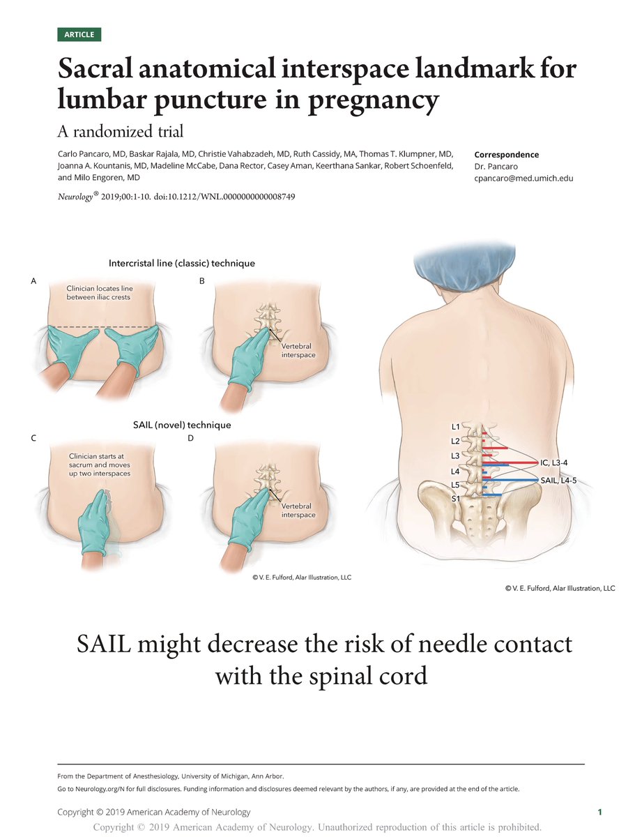 Lumbar Puncture Landmarks