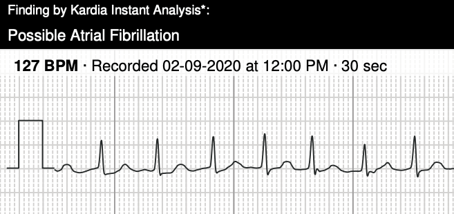 Atrial Fibrillation Ecg Dog